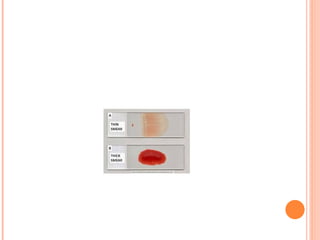 Blood Film Preparation and Staining preparation | PPTX