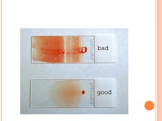 Blood Film Preparation and Staining preparation | PPTX