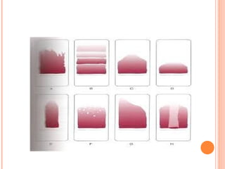 Blood Film Preparation and Staining preparation | PPTX