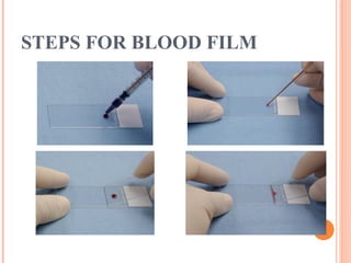 Blood Film Preparation and Staining preparation | PPTX