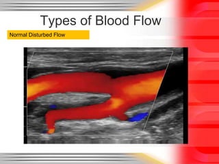 Blood flow types | PPTX