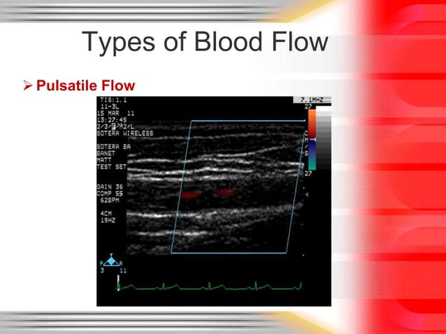 Blood flow types | PPTX