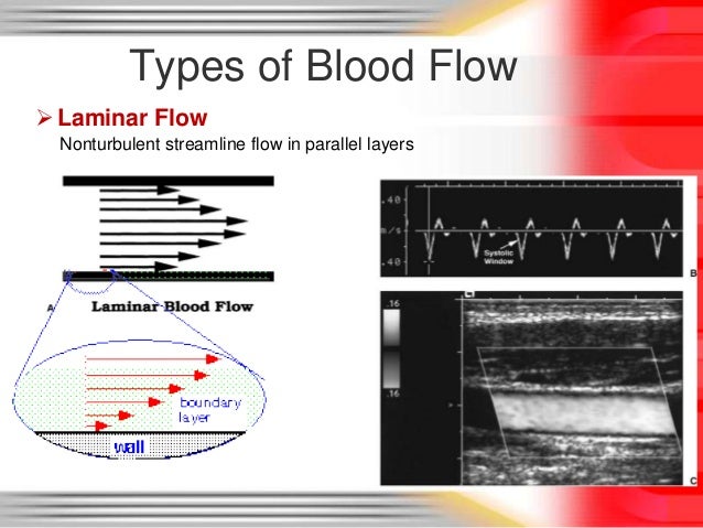 What Is Parabolic Flow - Design Talk