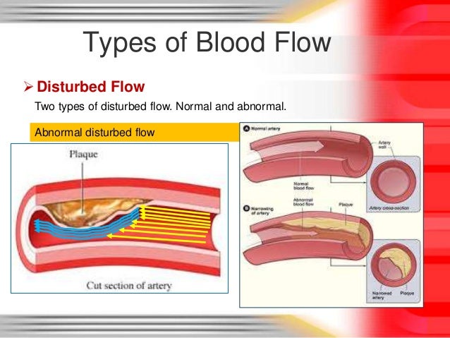Blood flow types