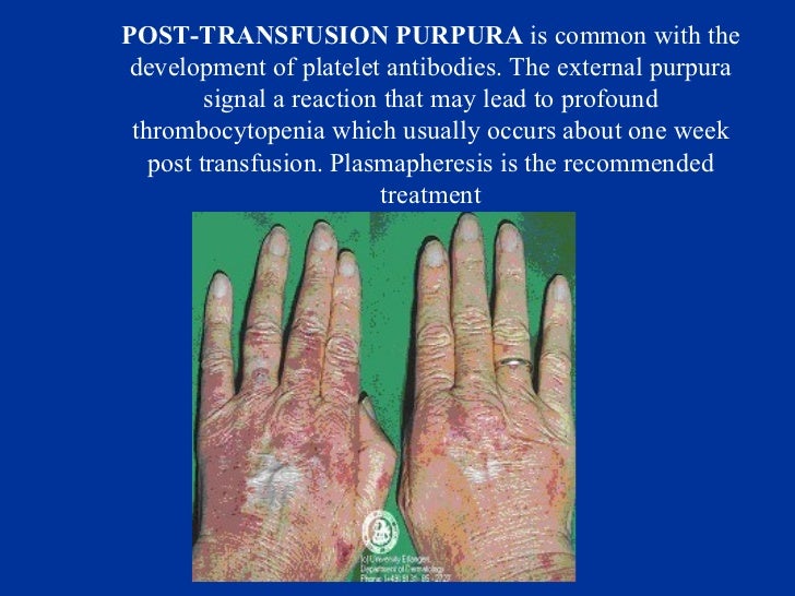 Bohomolets 3rd year Surgery Blood