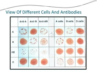 Blood group.007[1] | PPT