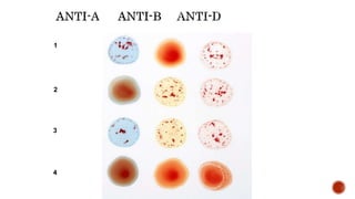 Blood group.pptx