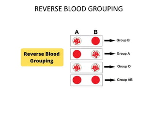 Blood group.pptx Blood grouping and Blood group system | PPTX ...