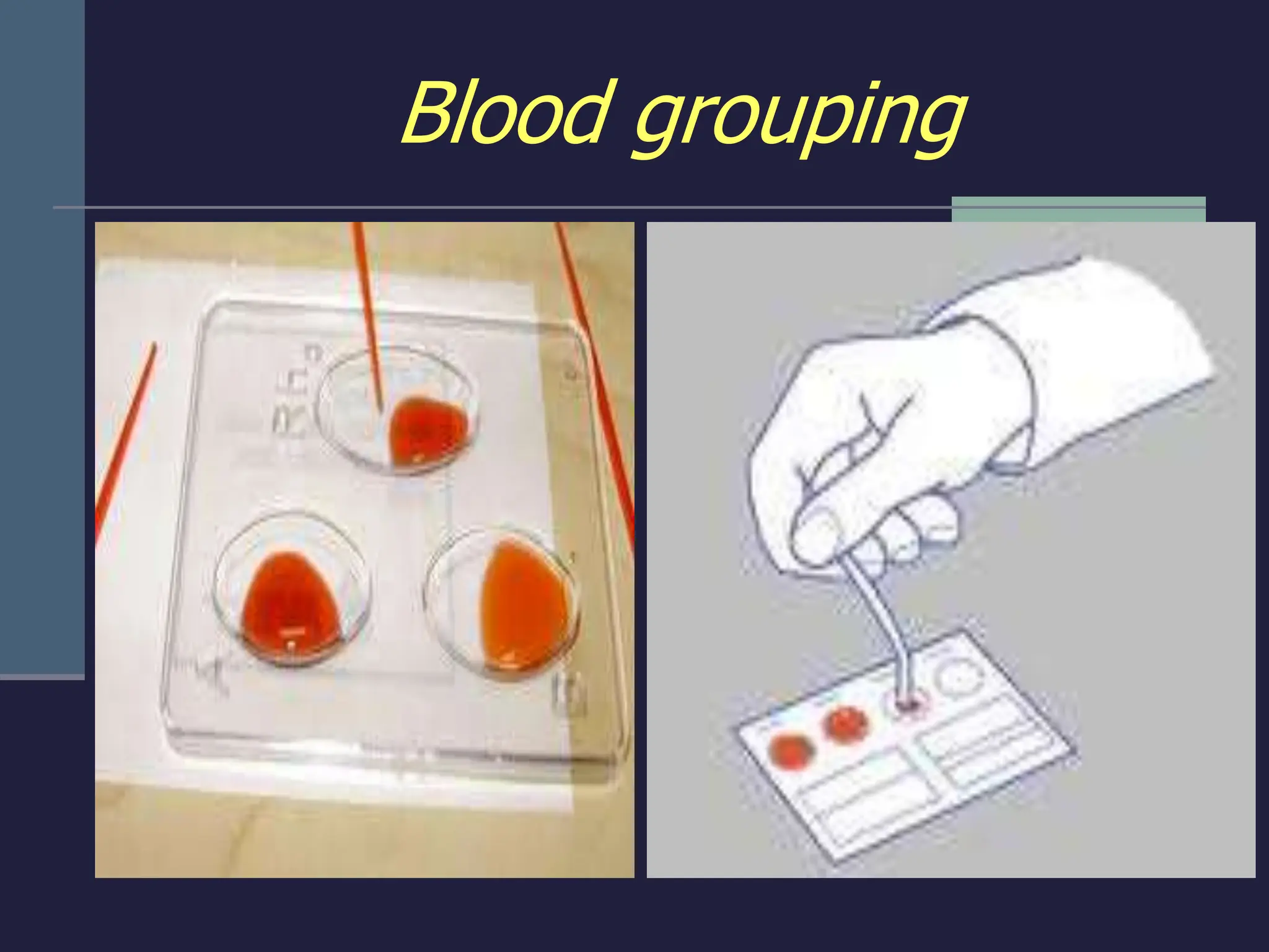 Blood Groups and abo grouping and RH system | PPT