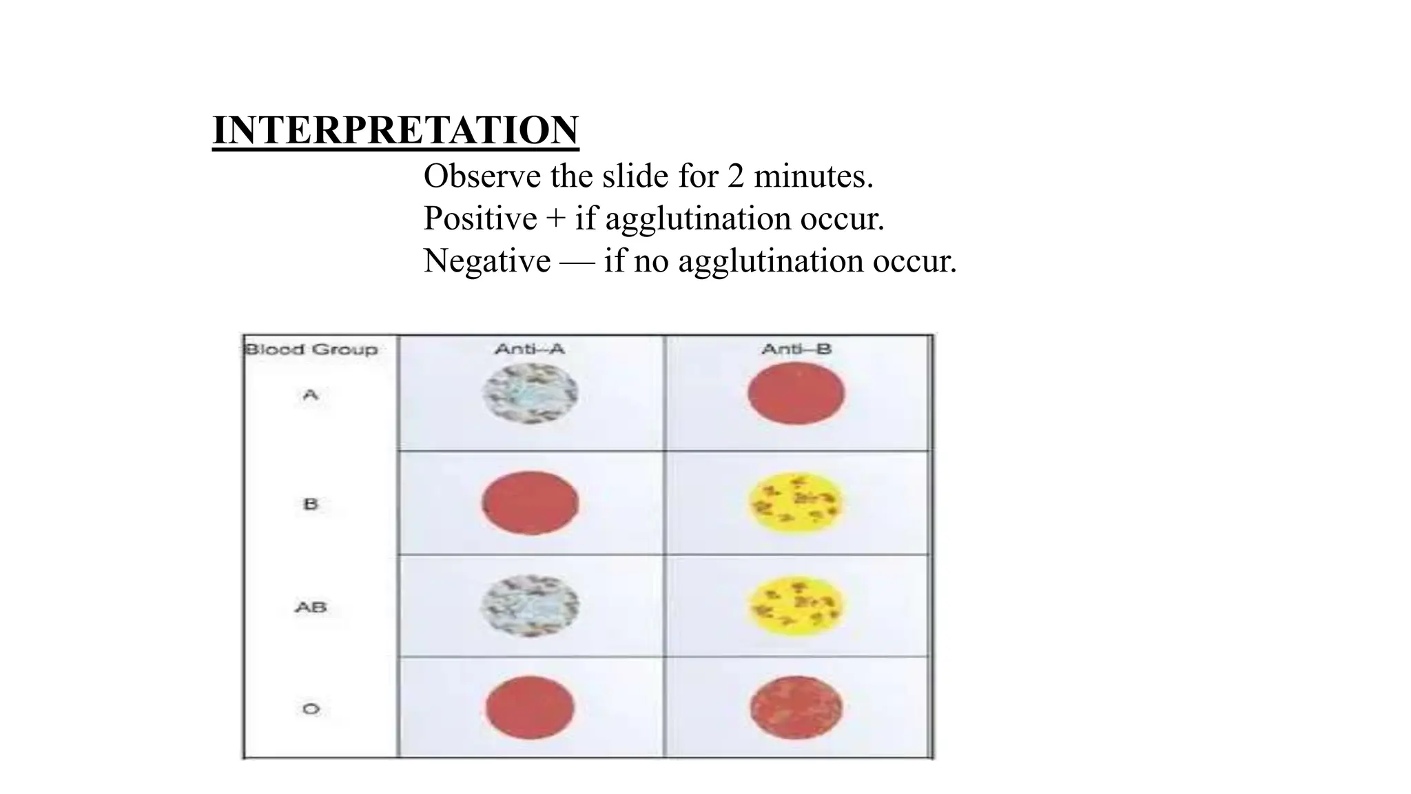 BLOOD GROUPING.pptx FOR DMLT BLOOD BANKING & HEMATOLOGY | PPTX