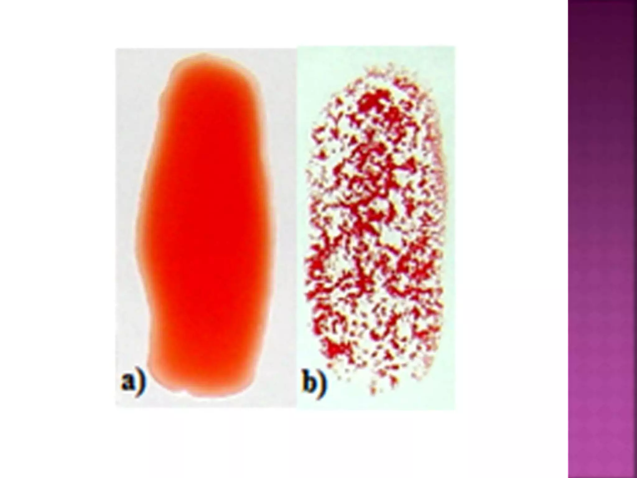 Blood grouping and crosss matching | PPTX