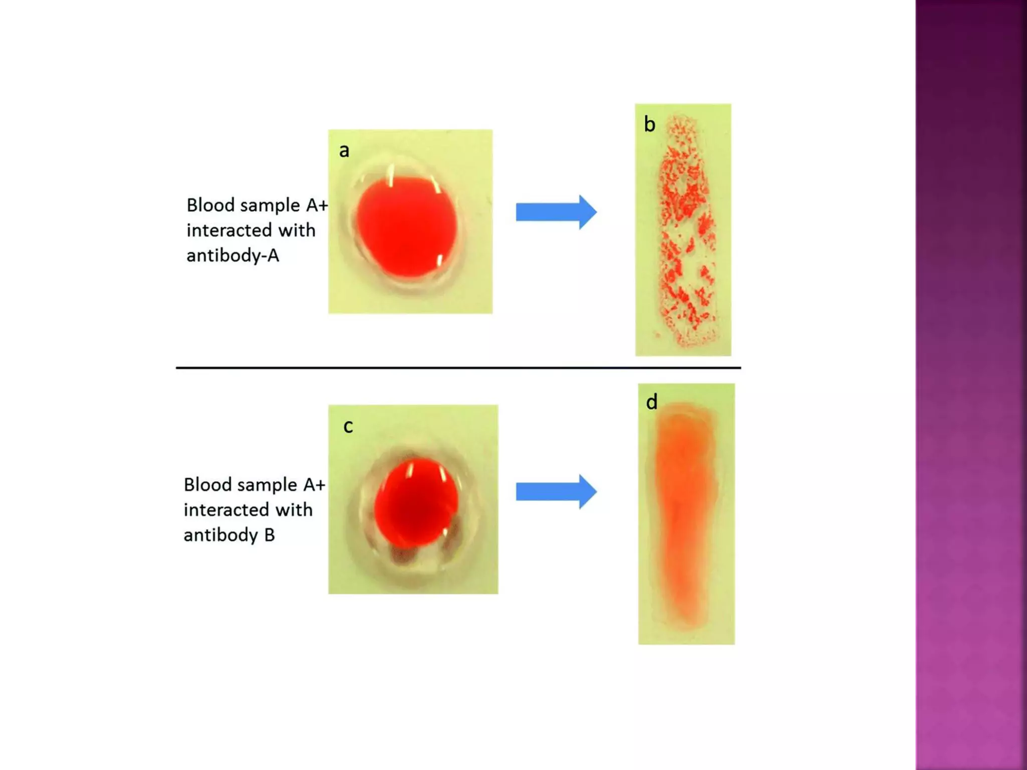 Blood grouping and crosss matching | PPTX