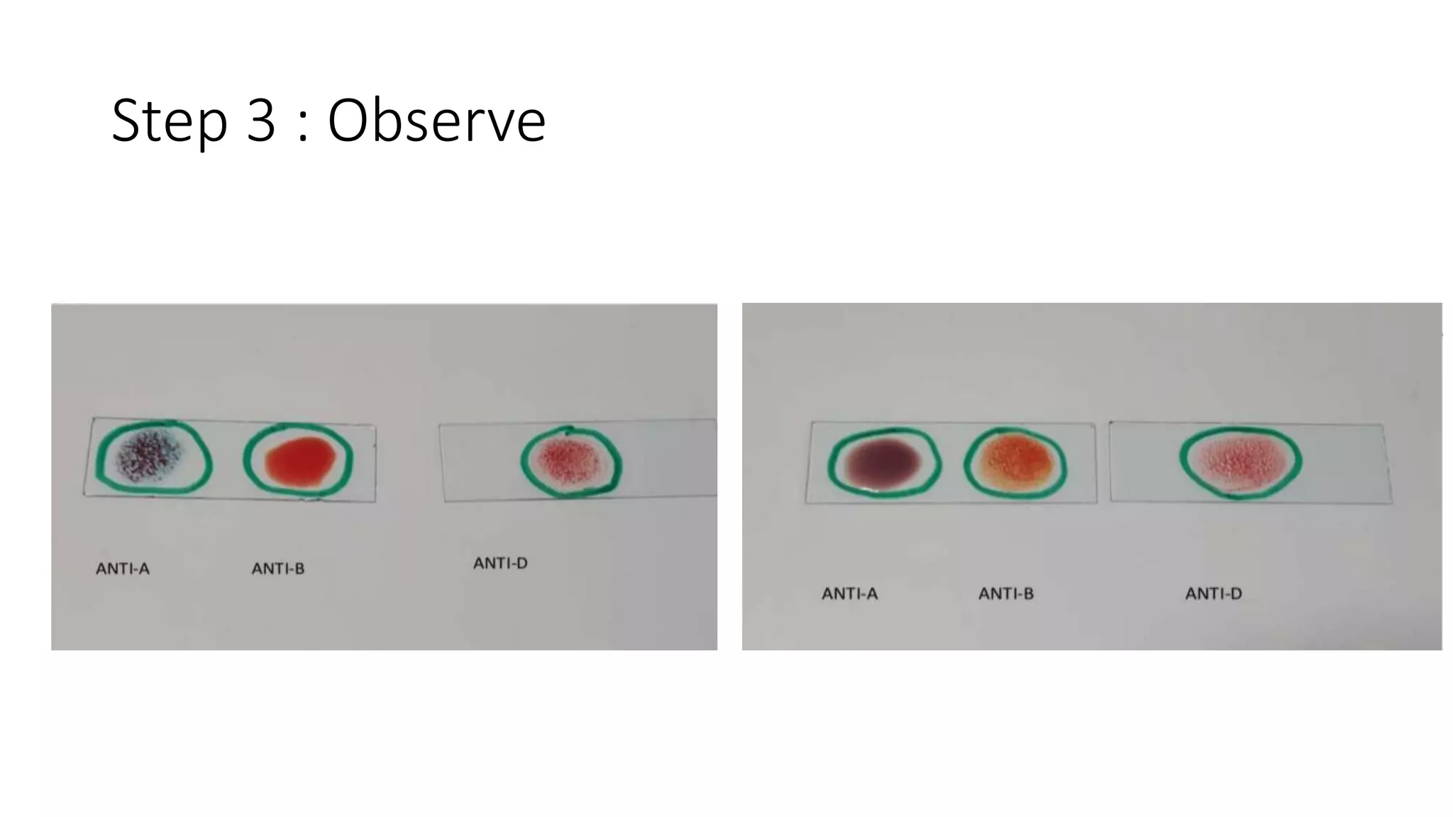 Blood grouping and Cross matching | PPTX