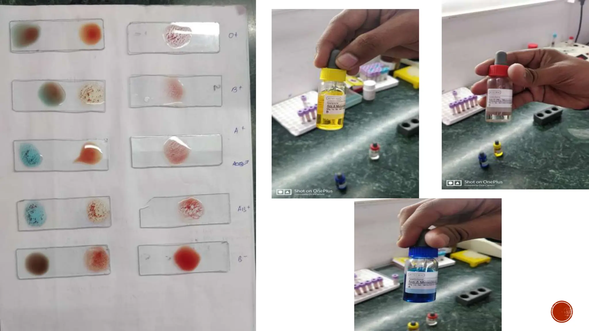blood grouping crossmatching n components-1.pptx