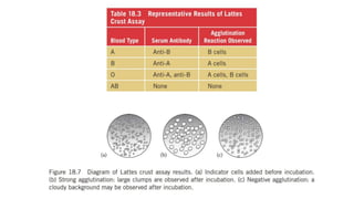 Blood grouping from bloodstains.pptx