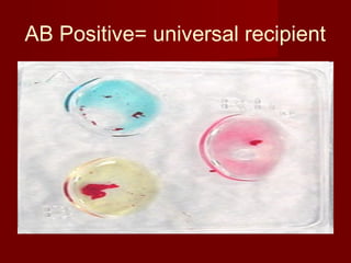 Blood groups and typing | PPT