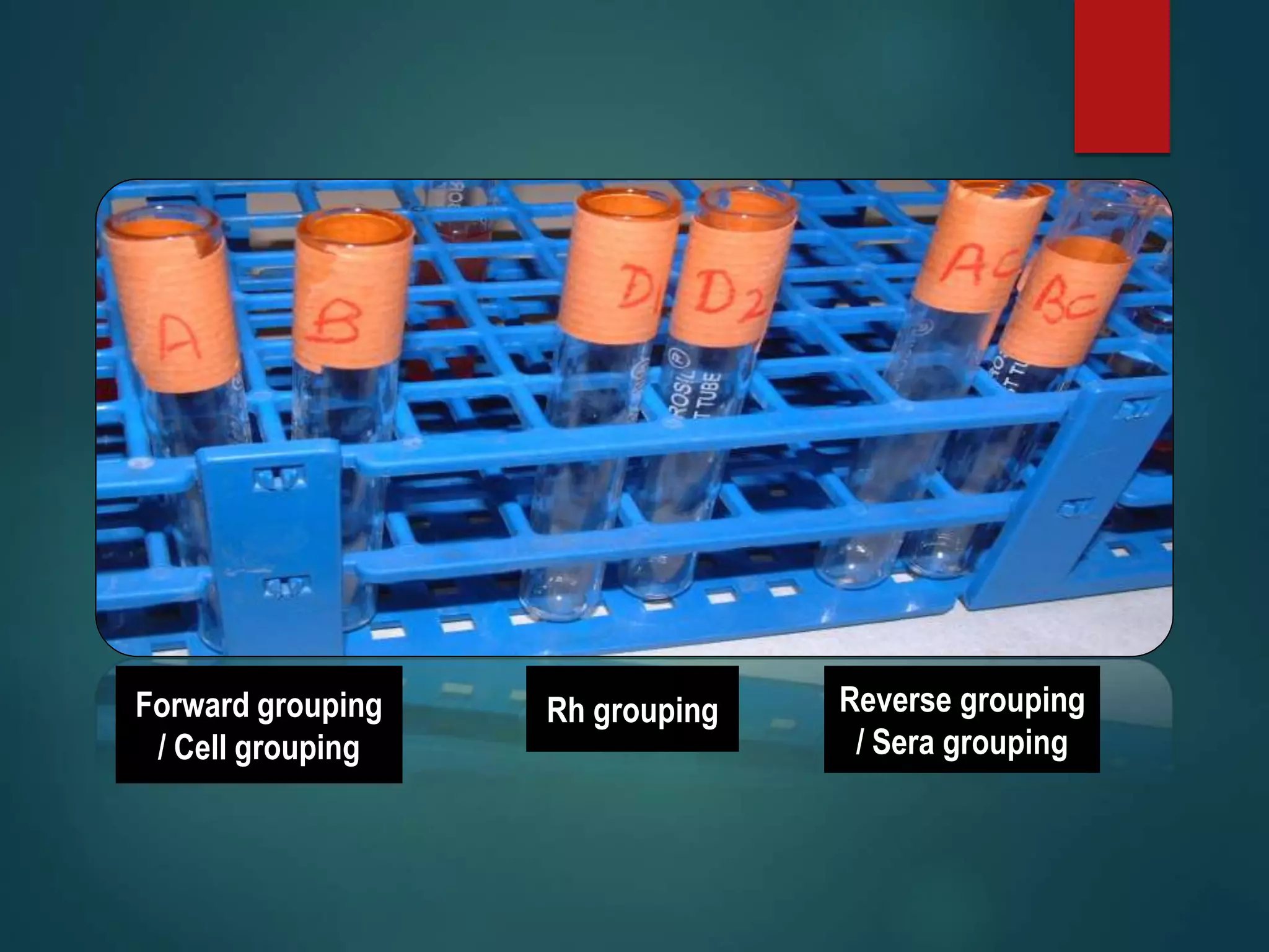 Blood Group Systems_ABO & Rh.ppt