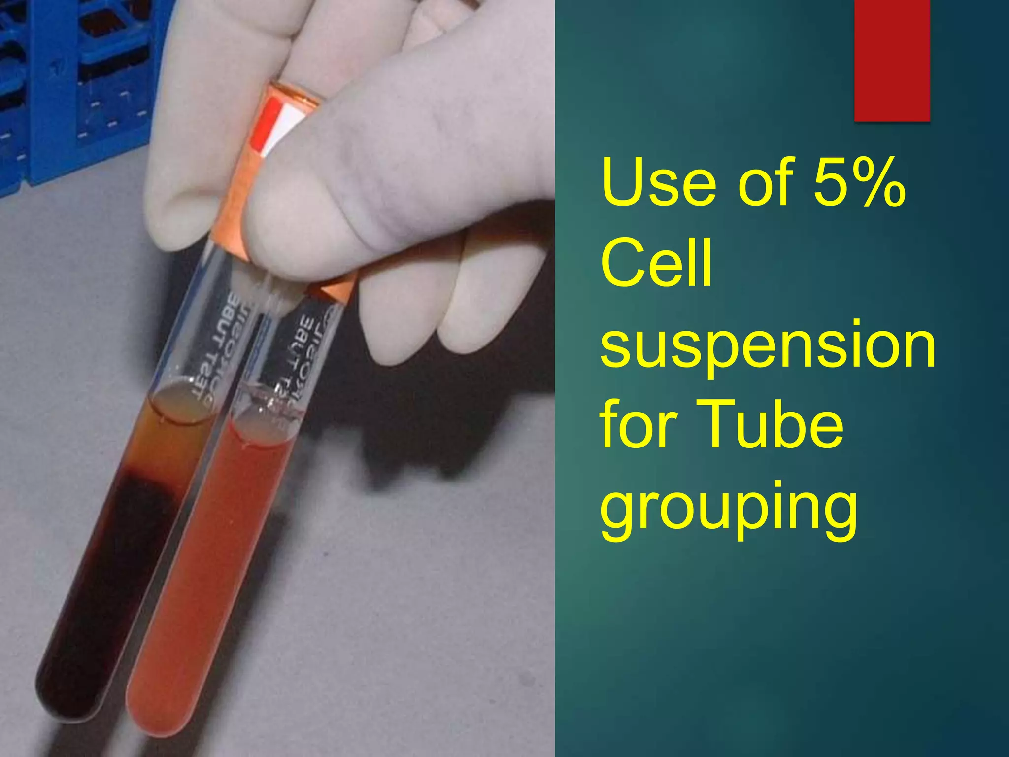 Blood Group Systems_ABO & Rh.ppt
