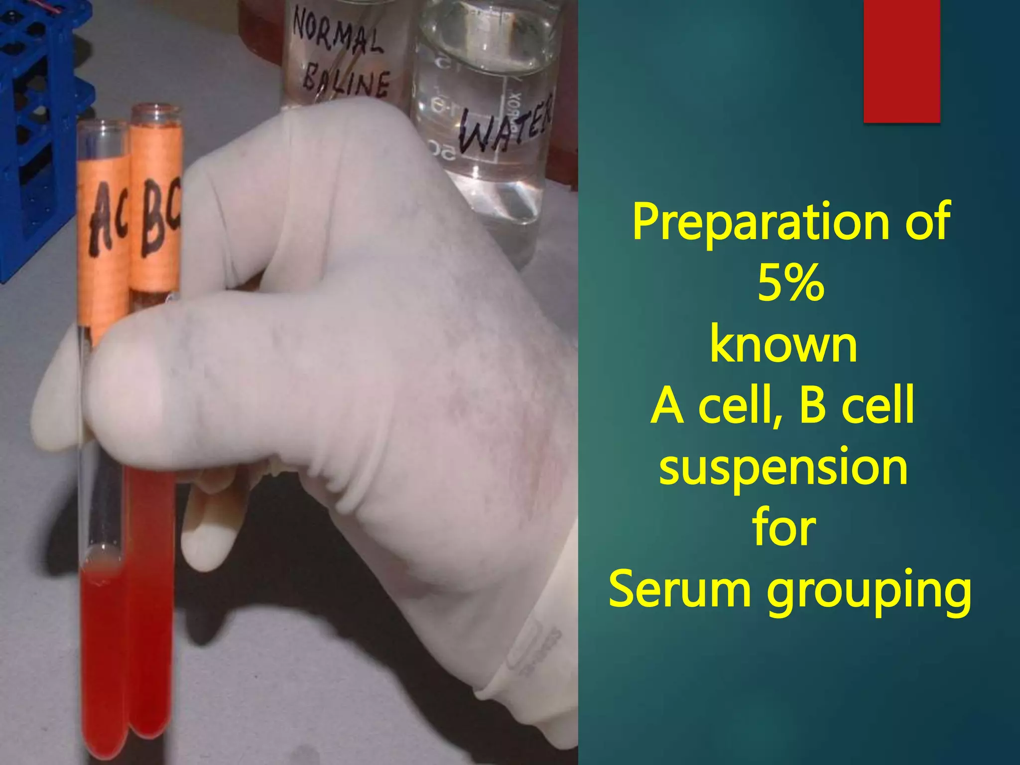 Blood Group Systems_ABO & Rh.ppt