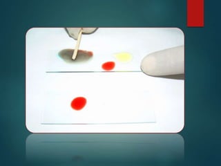 Blood Group Systems_ABO & Rh.ppt