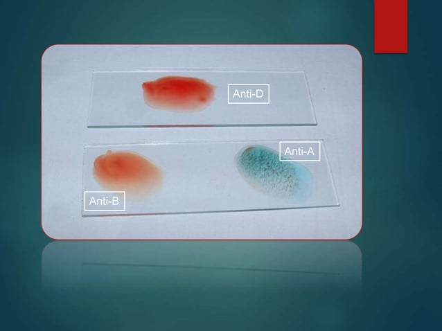 Blood Group Systems_ABO & Rh.ppt | Blood Disorders | Diseases and ...