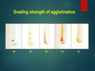 Blood Group Systems_ABO & Rh.ppt
