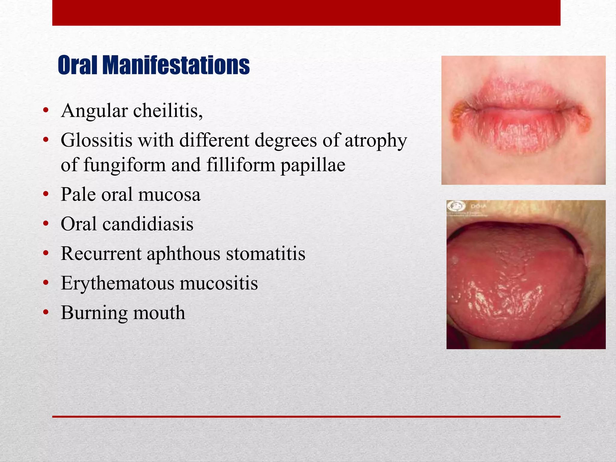 Blood disorders ppt | PPTX