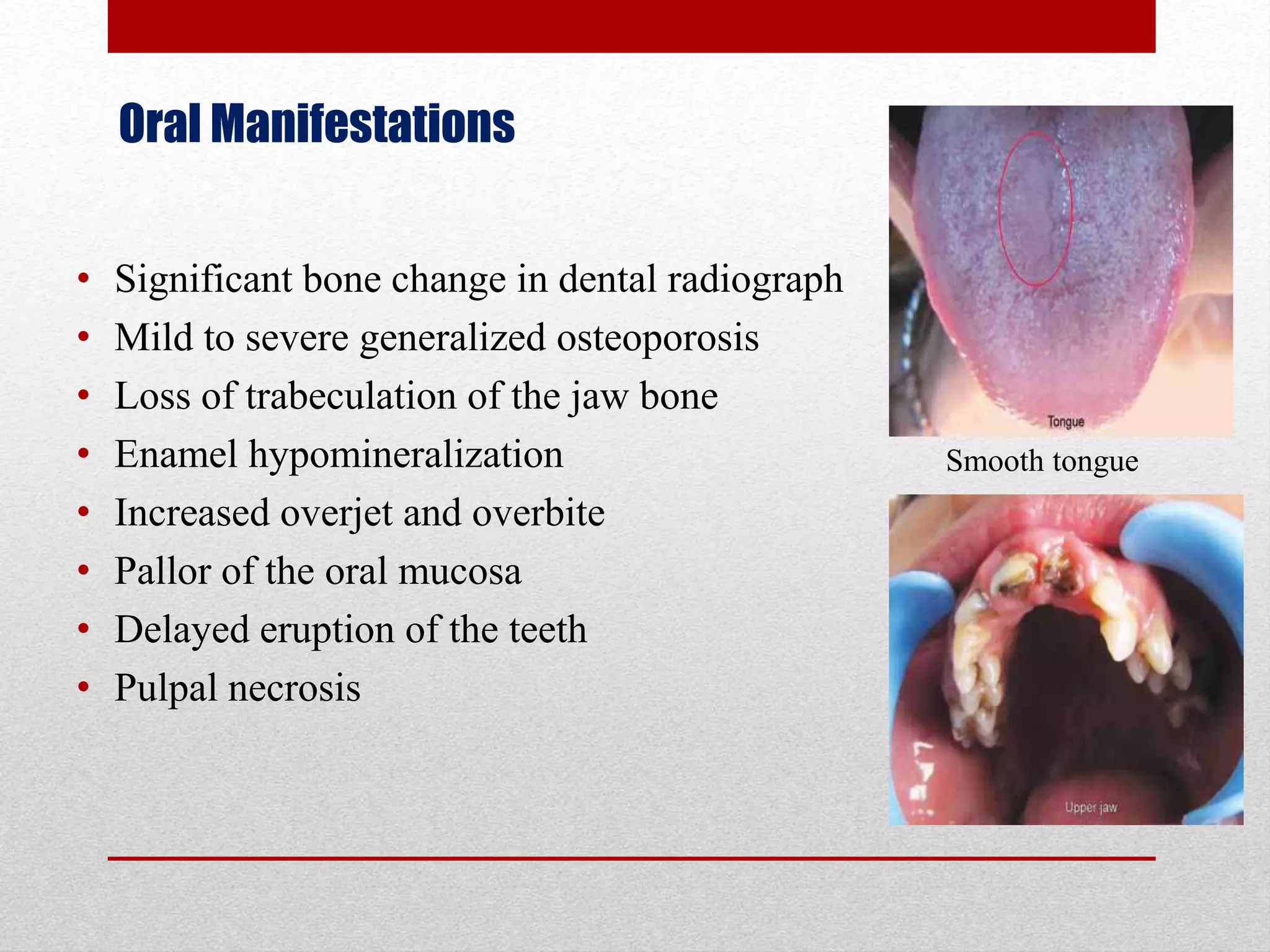 Blood disorders ppt | PPTX