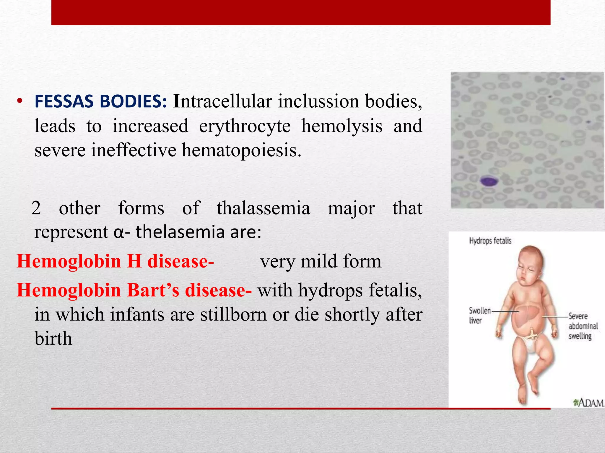 Blood disorders ppt | PPTX
