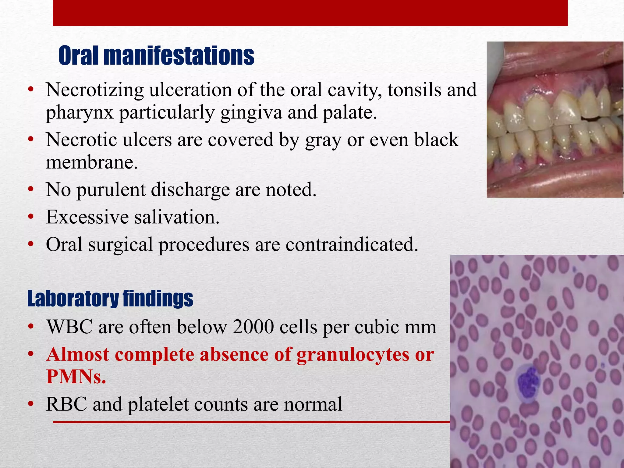 Blood disorders ppt | PPTX