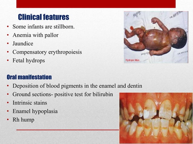 Blood disorders ppt | PPTX | Blood Disorders | Diseases and Conditions