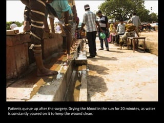 Bloodletting ppt | PPTX