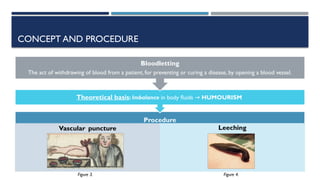 Bloodletting (Scribd) - Inglés Médico 3ºMED | PPT