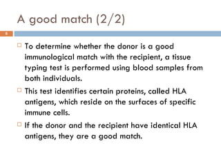 HLA Matching | PPT