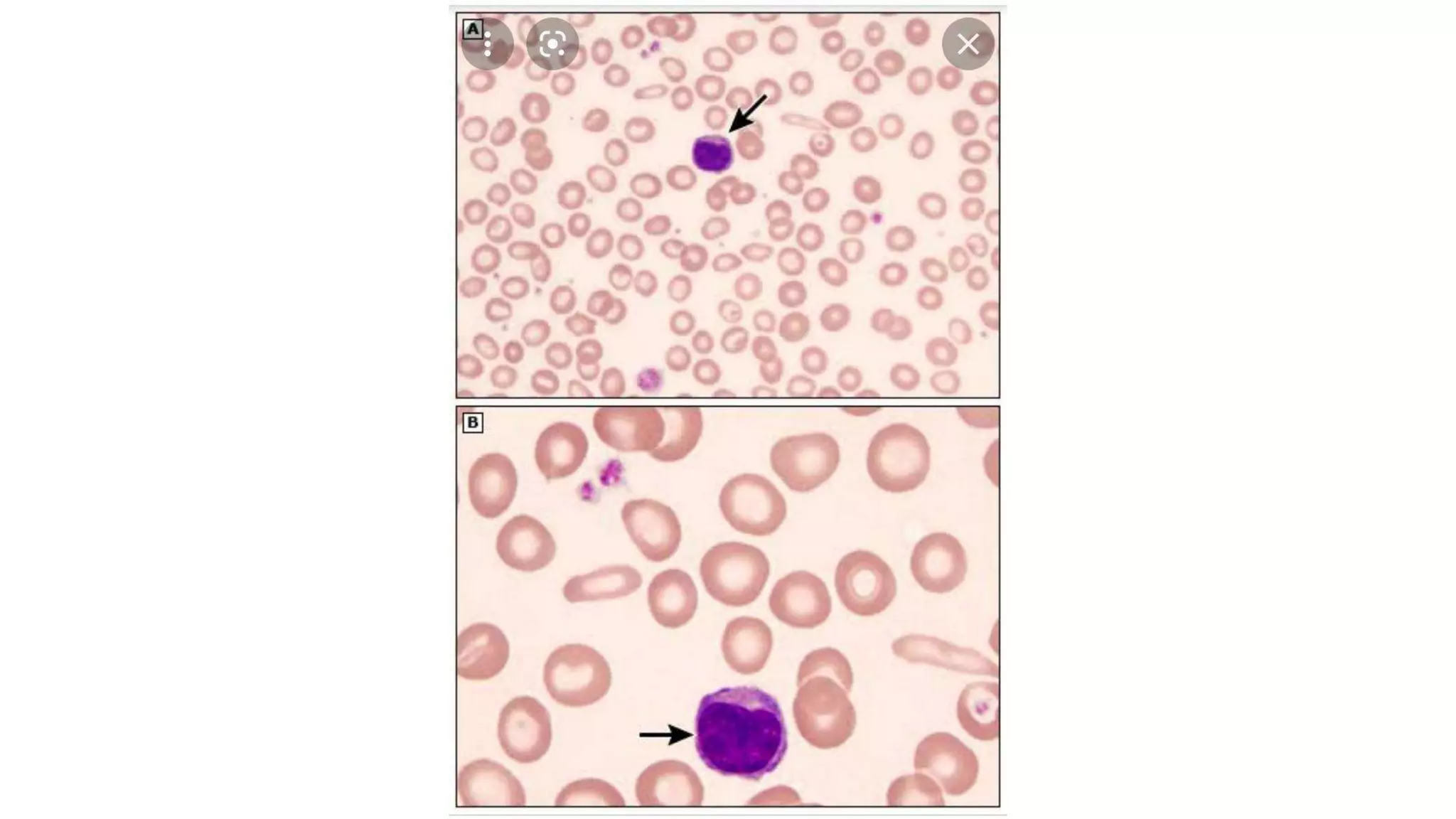 Blood module practicals | PPT
