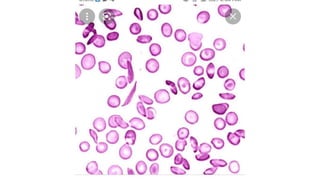 Blood module practicals | PPT