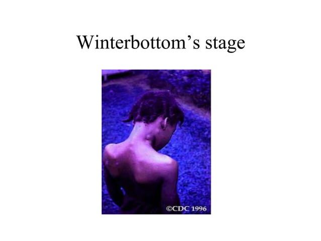 Blood parasites (1).ppt parasitology zoology | PPT