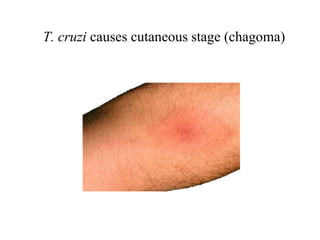 Blood parasites (1).ppt parasitology zoology | PPT
