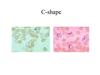 Blood parasites (1).ppt parasitology zoology | PPT