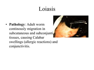 Blood parasites (1).ppt parasitology zoology | PPT