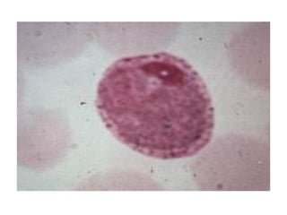 Different Types Of The blood parasites 2.ppt