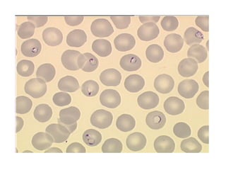 Different Types Of The blood parasites 2.ppt