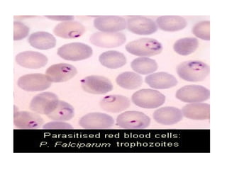 Different Types Of The blood parasites 2.ppt