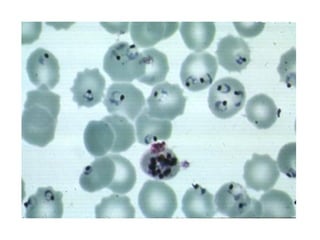 Different Types Of The blood parasites 2.ppt