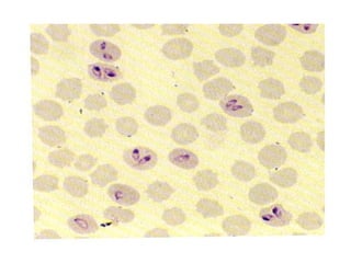 Different Types Of The blood parasites 2.ppt