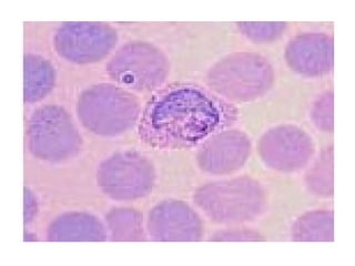 Different Types Of The blood parasites 2.ppt