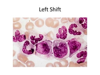 Blood pathophysiology | PPTX