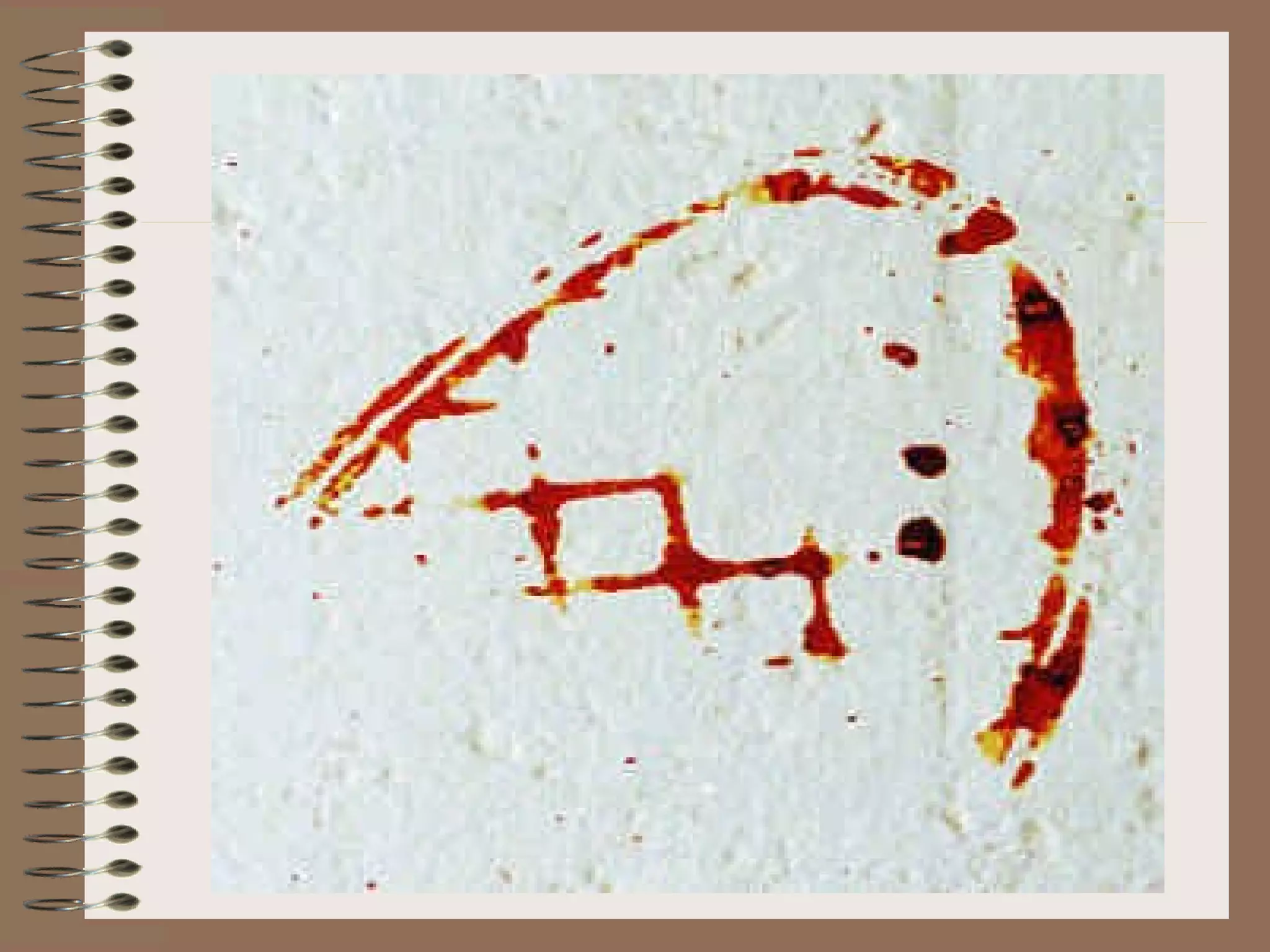 Blood pattern analysis | PPT