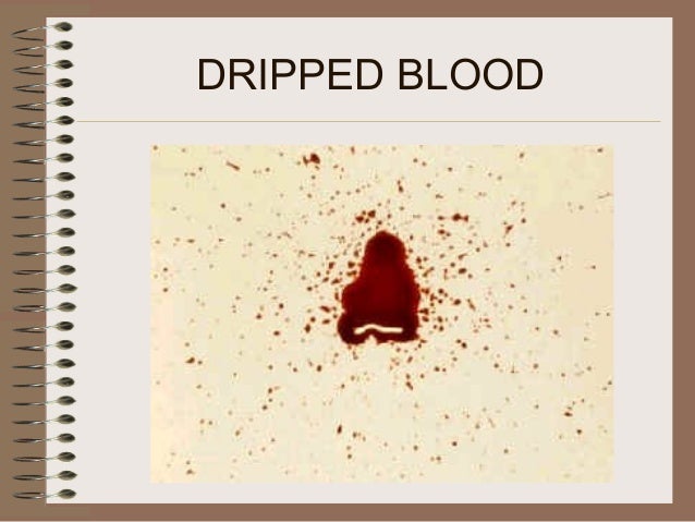 Blood pattern analysis