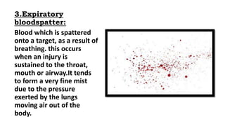 Blood pattern analysis | PPTX